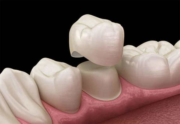 Home - Smile Creations